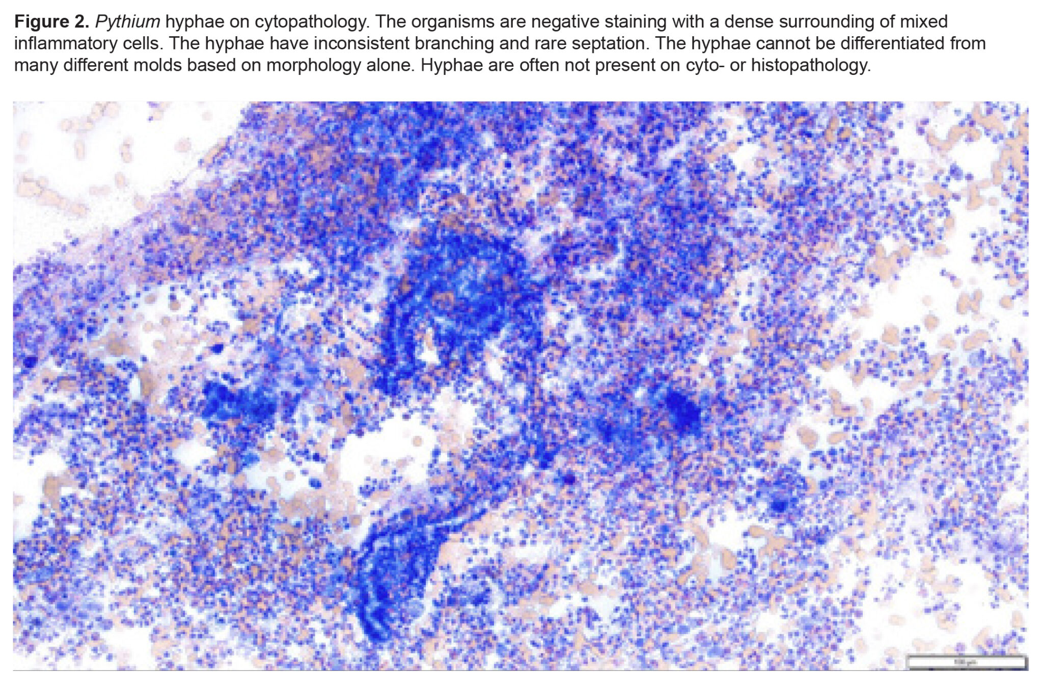 Pythiosis in Small Animals - MiraVista VETERINARY Diagnostics