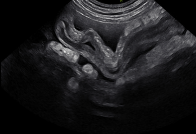 Pythiosis in Small Animals - MiraVista VETERINARY Diagnostics