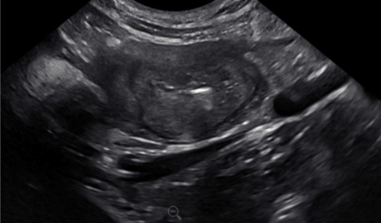 Pythiosis in Small Animals - MiraVista VETERINARY Diagnostics